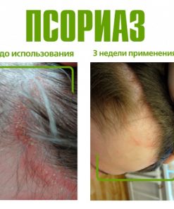 Купить мазь Магнипсор, отзывы, цена - Официальный магазин!